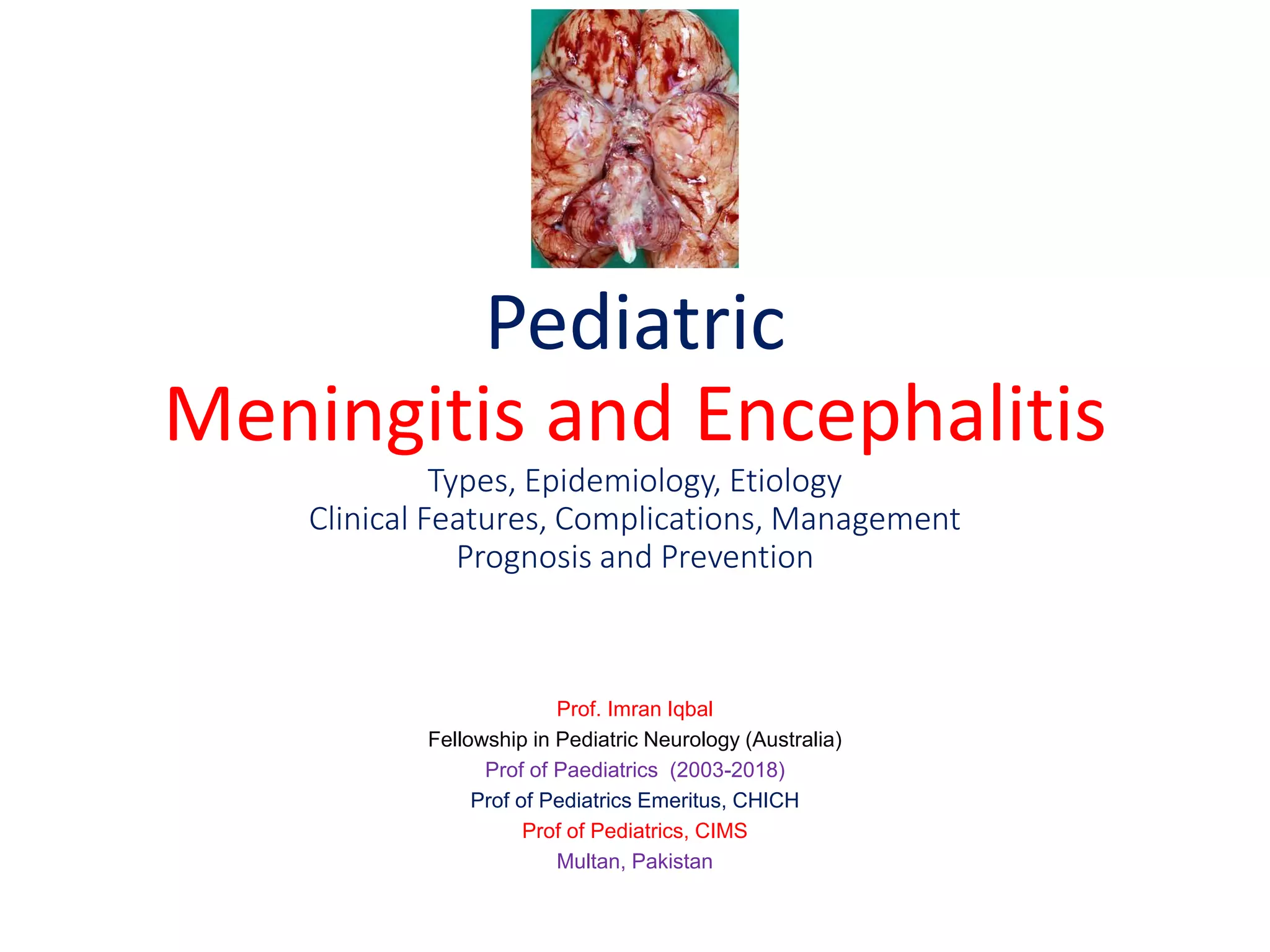 Pediatric meningitis and encephalitis 2021 | PPTX