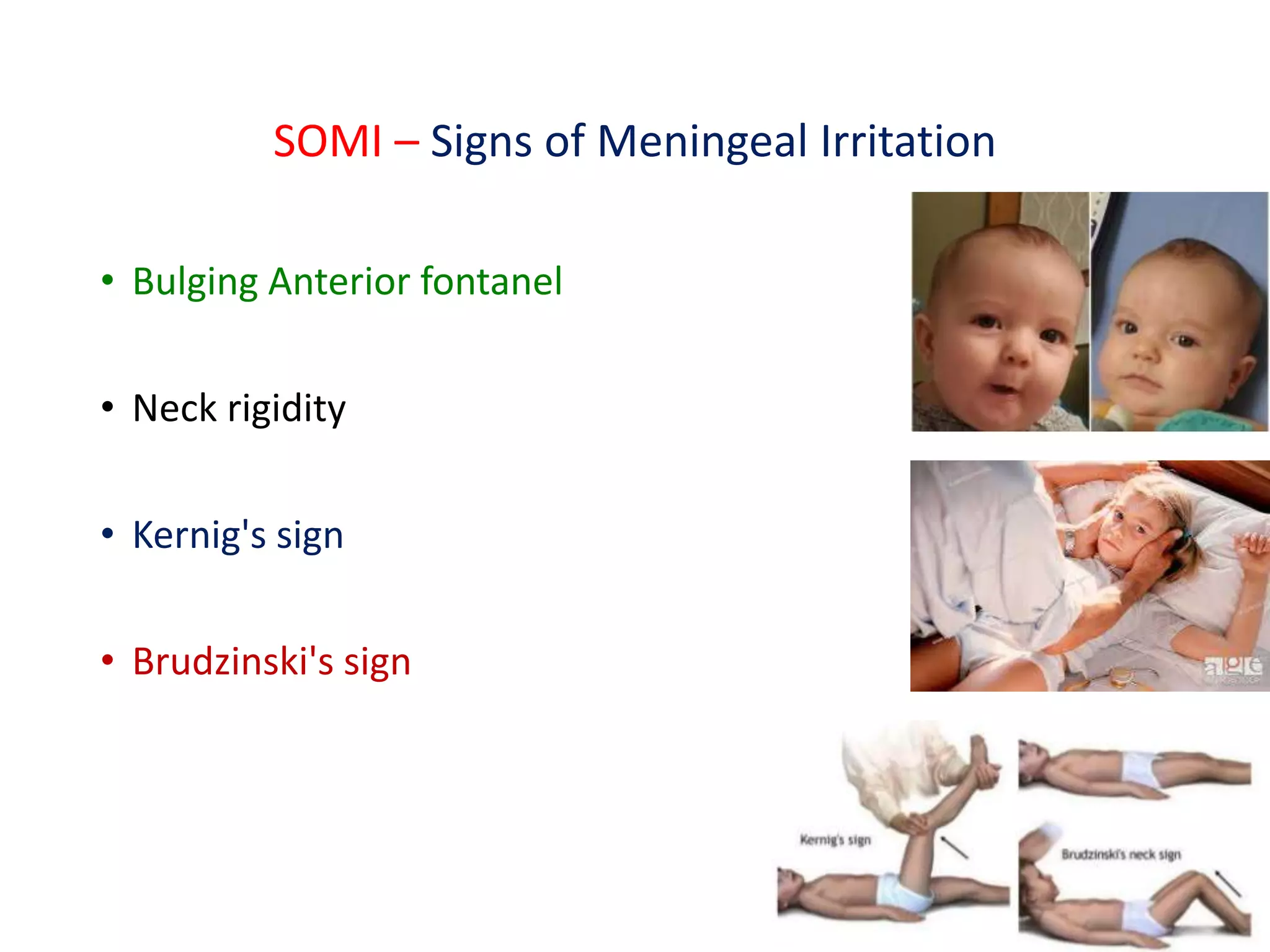 Pediatric meningitis and encephalitis 2021 | PPTX