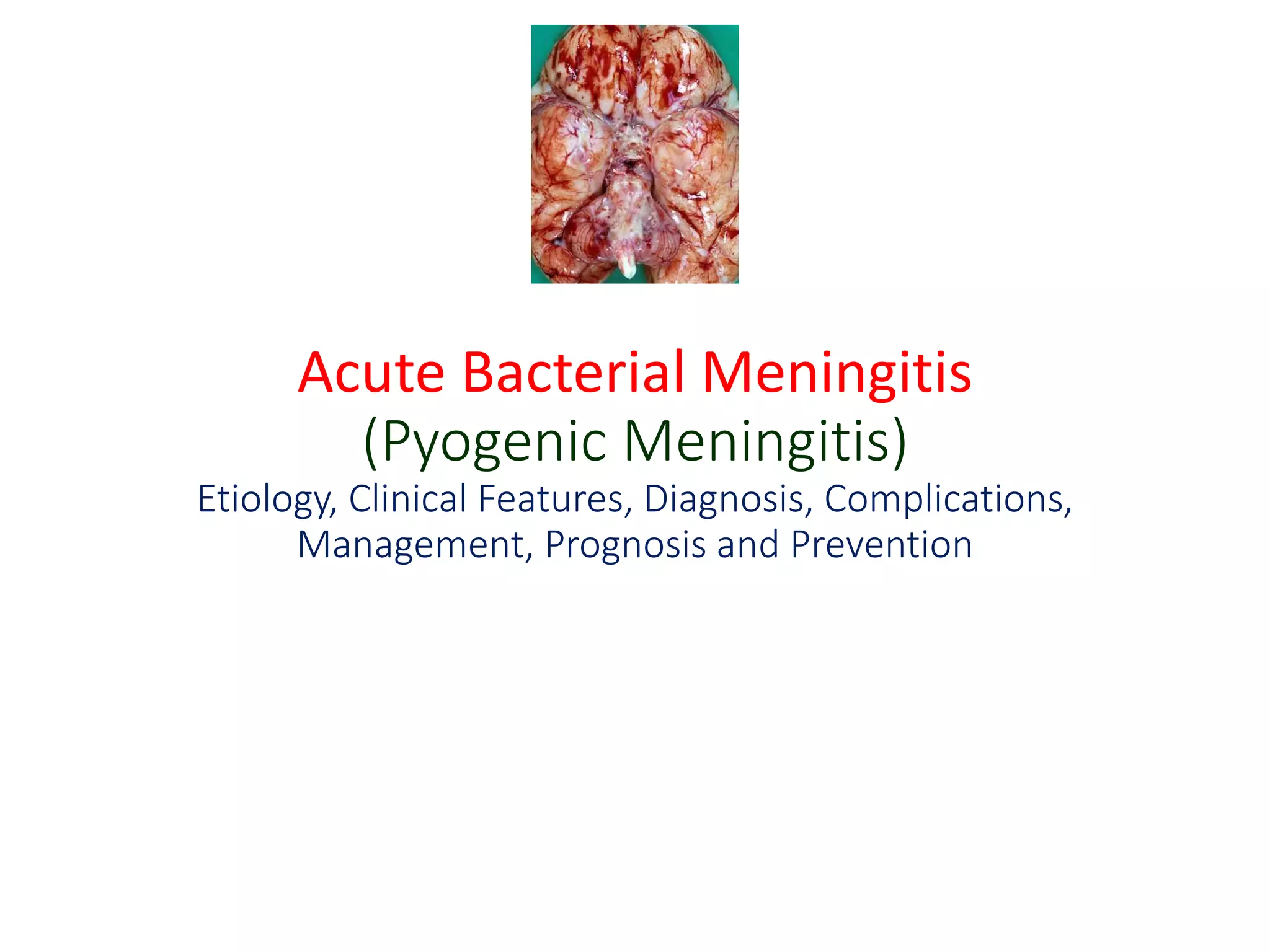 Pediatric meningitis and encephalitis 2021 | PPTX