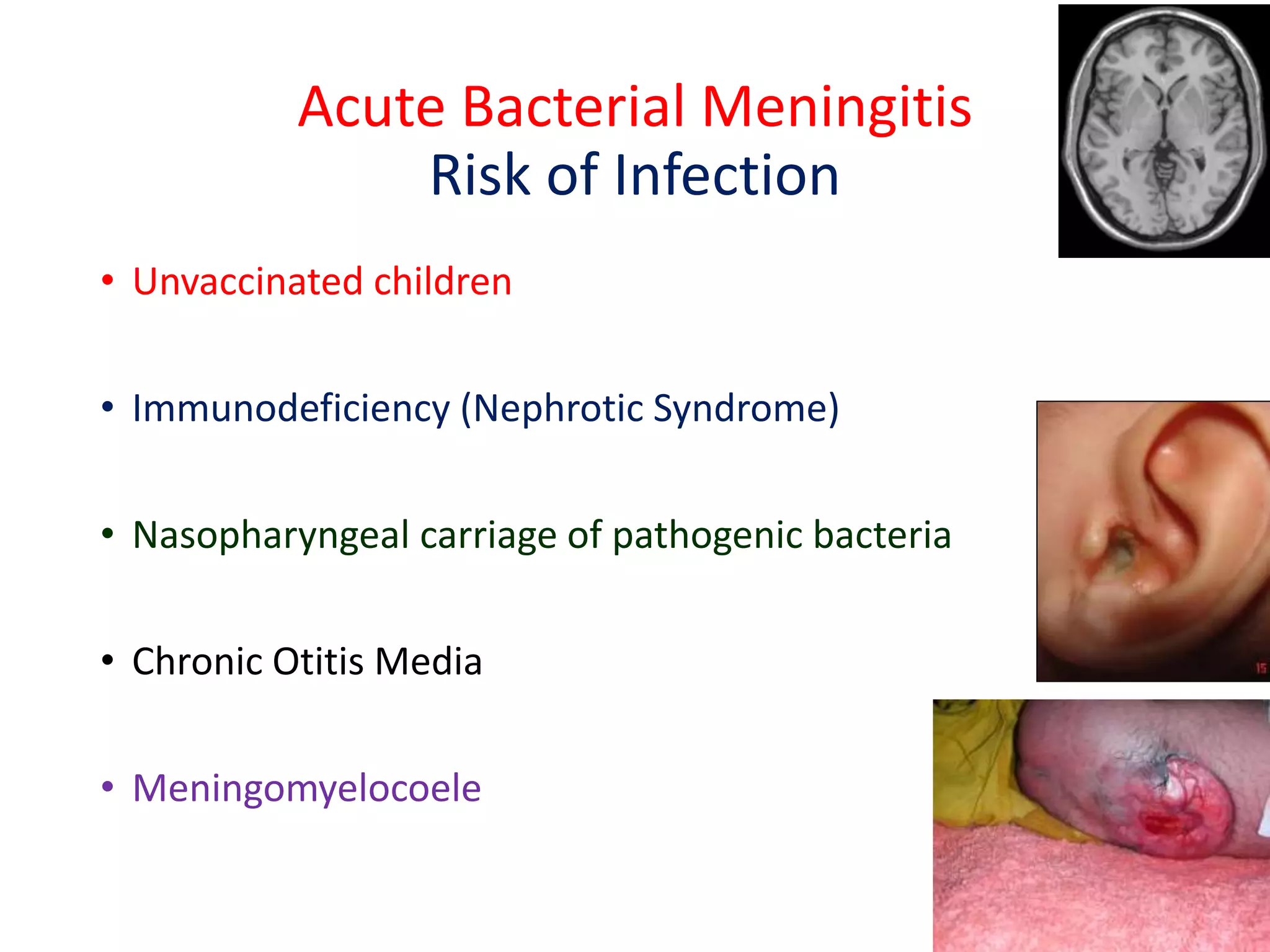 Pediatric meningitis and encephalitis 2021 | PPTX