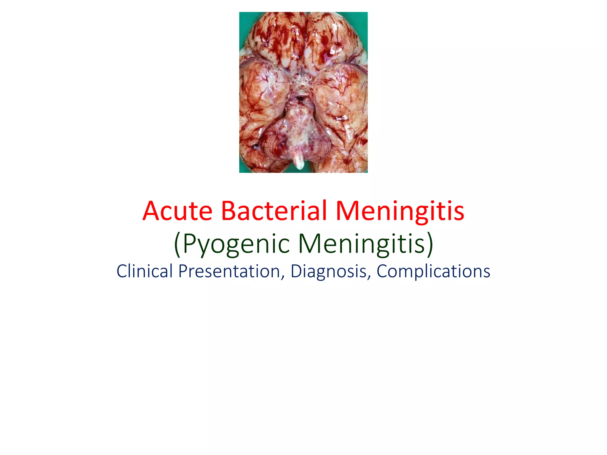 Pediatric meningitis and encephalitis 2021 | PPTX