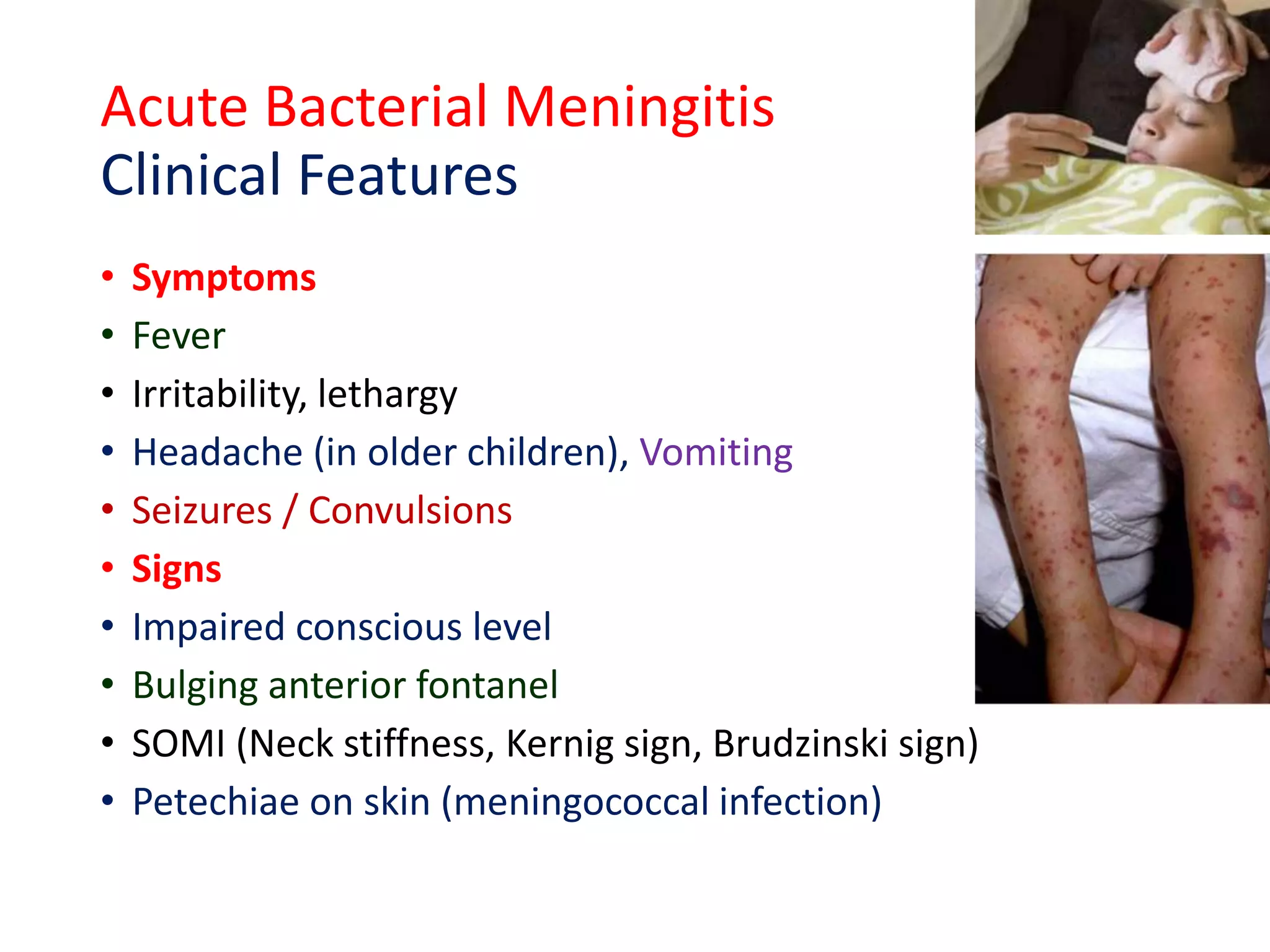 Pediatric meningitis and encephalitis 2021 | PPTX