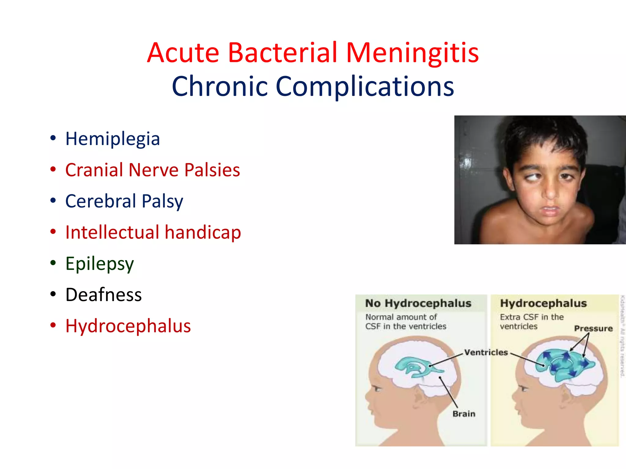 Pediatric meningitis and encephalitis 2021 | PPTX