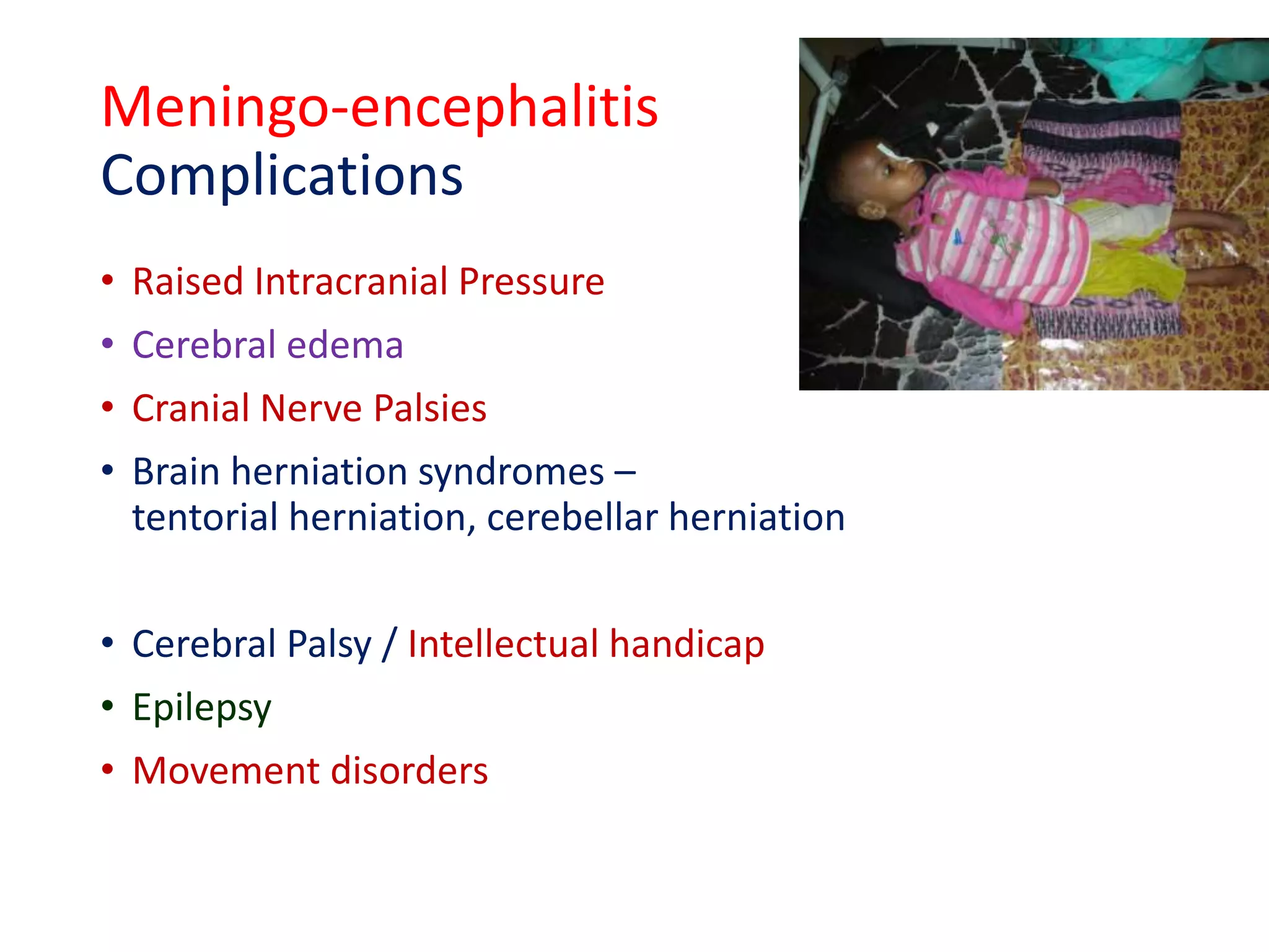 Pediatric meningitis and encephalitis 2021 | PPTX