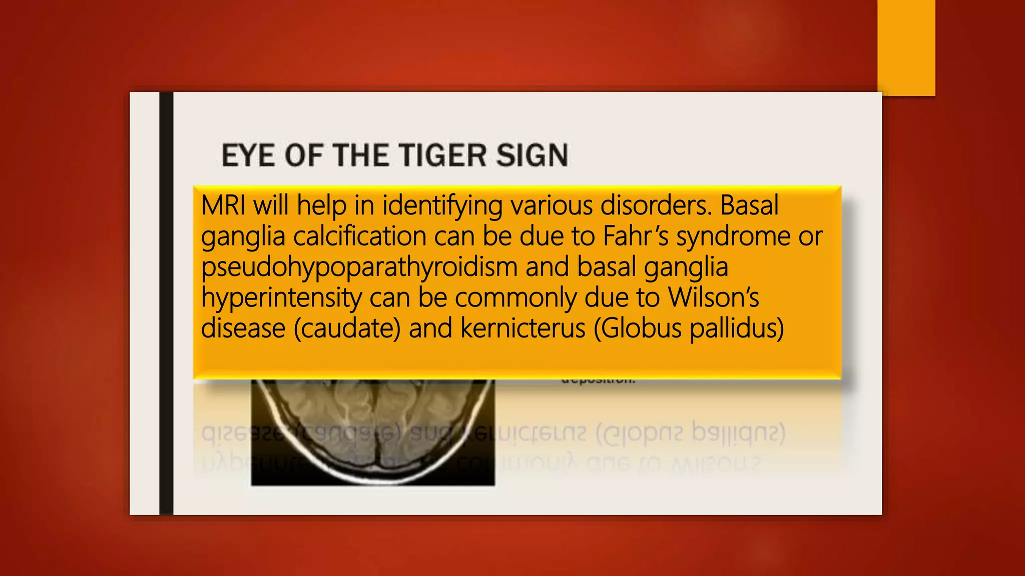 Pediatric movement disorders | PPTX