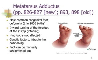 Pediatric musculoskeletal nurs 3340 fall 2017 | PPTX
