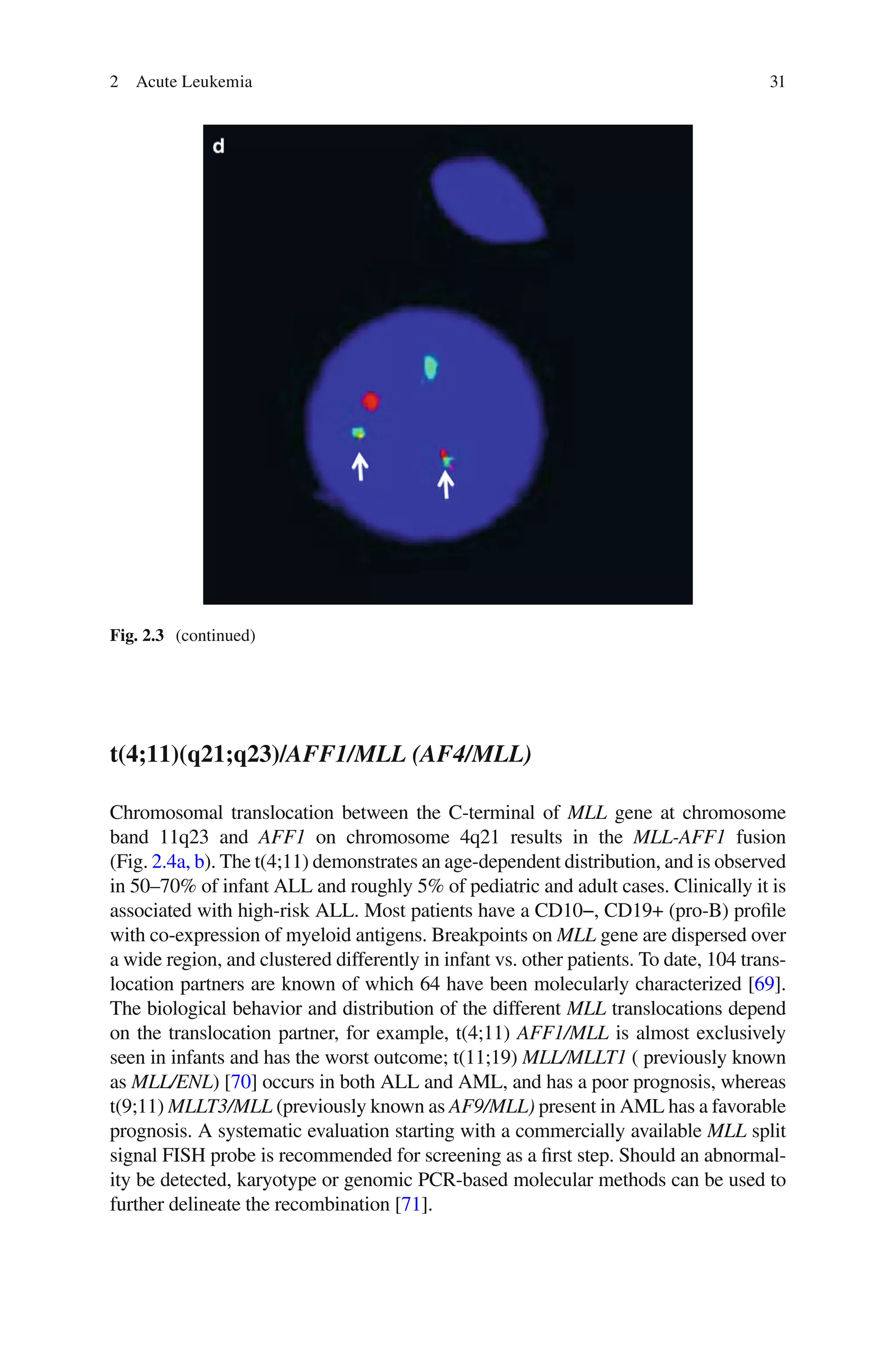 Pediatric neoplasia | PDF