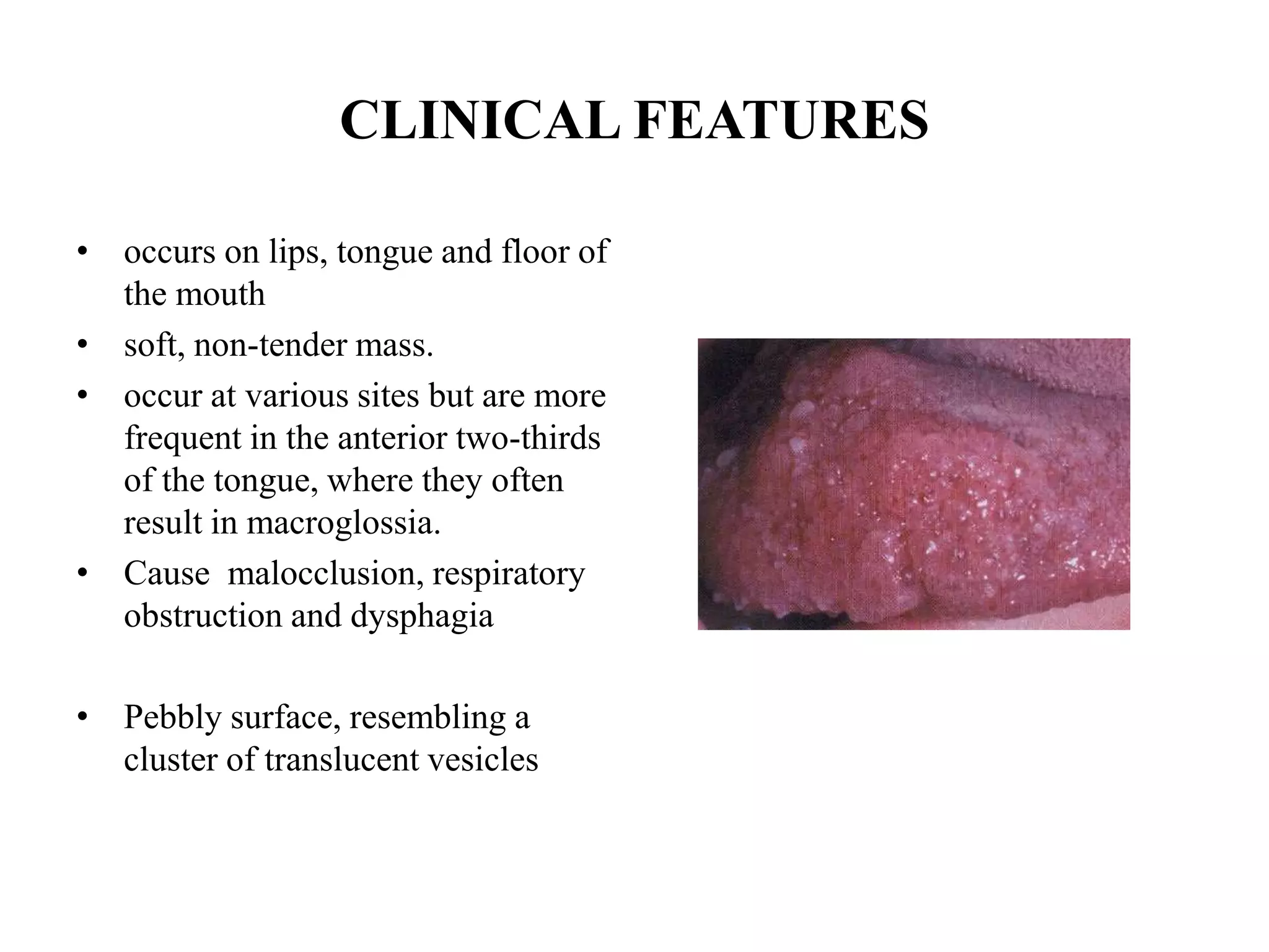 Pediatric neoplasm affecting the oral cavity | PPTX