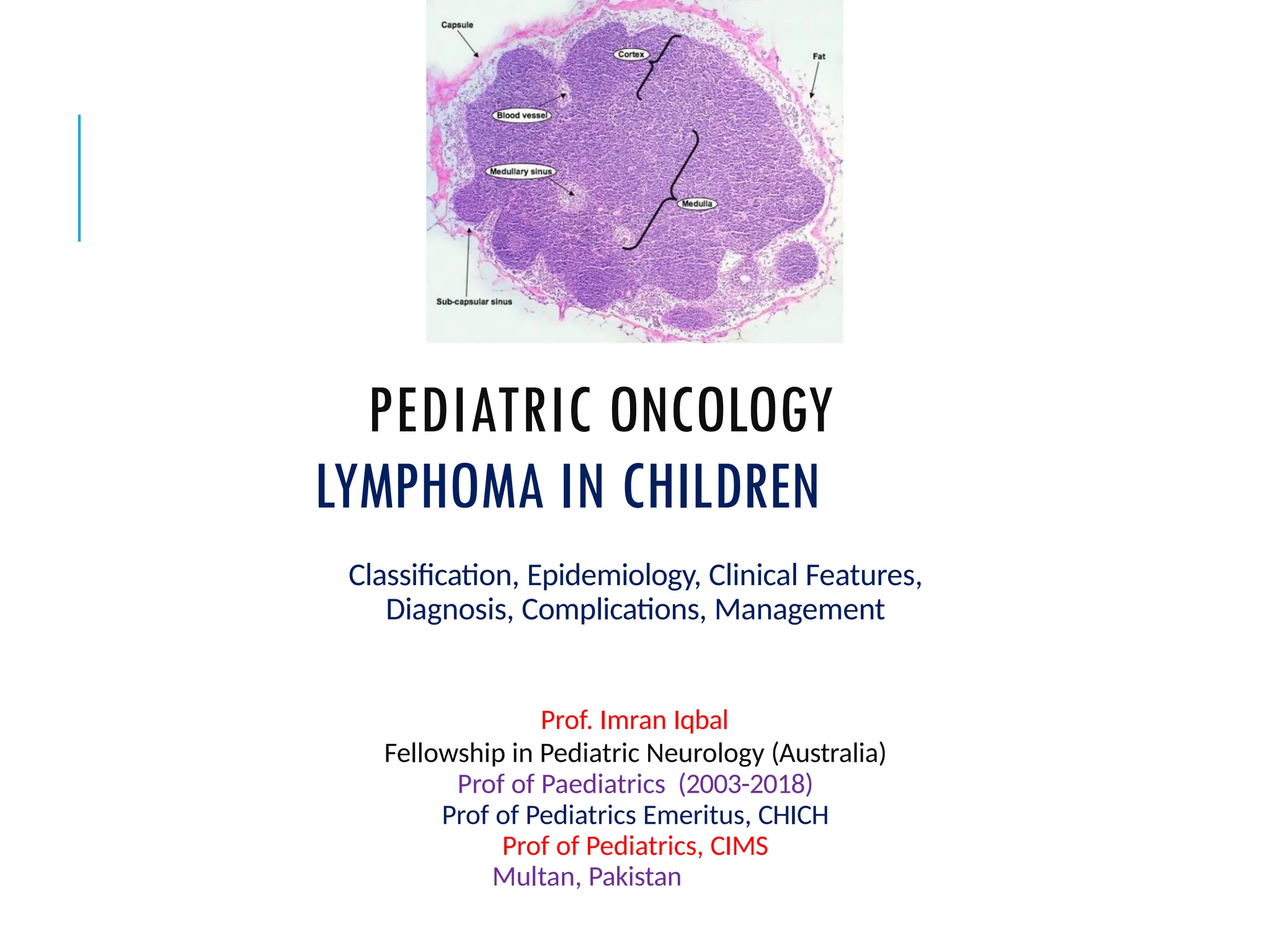 pediatric neoplastic disorders-ALL,AML,LYMPHOMAS | PPTX