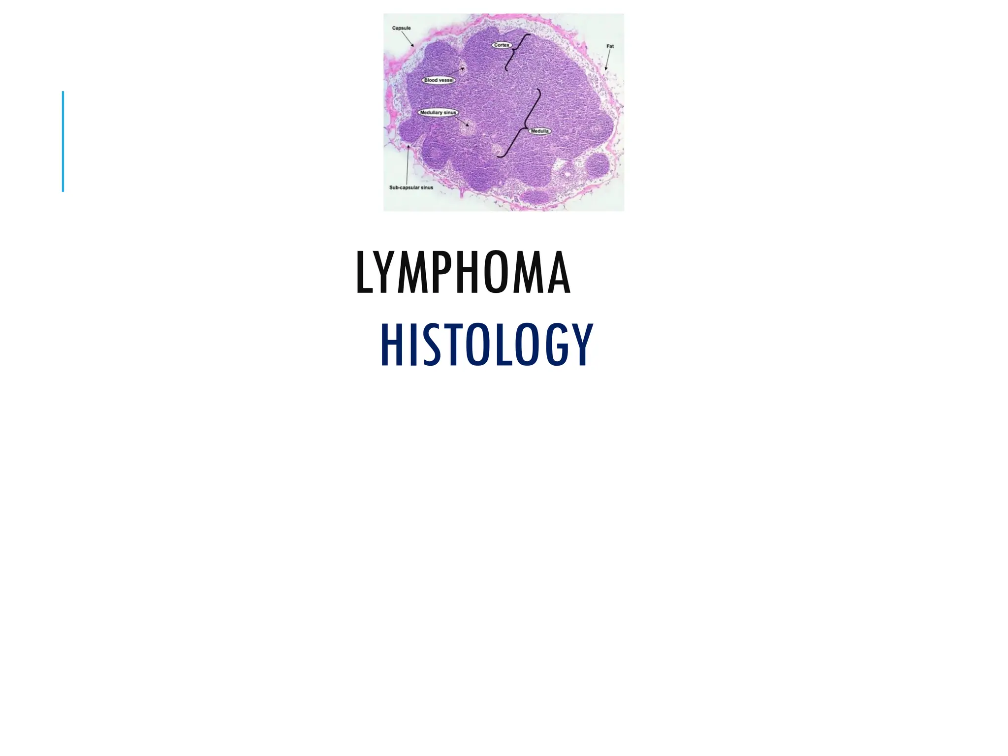 pediatric neoplastic disorders-ALL,AML,LYMPHOMAS | PPT | Free Download
