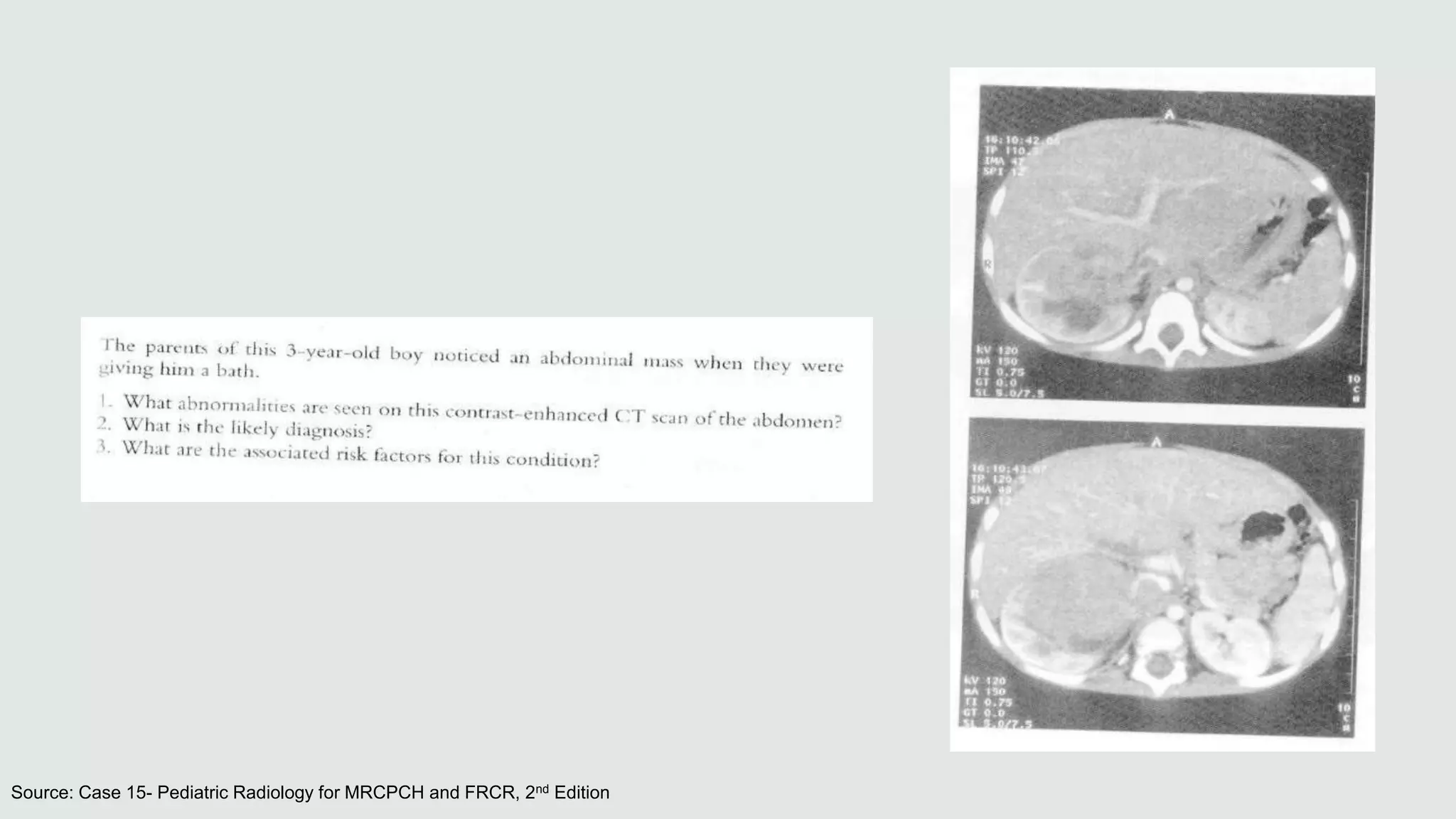 Pediatric Nephrology Radiology Review | PPT