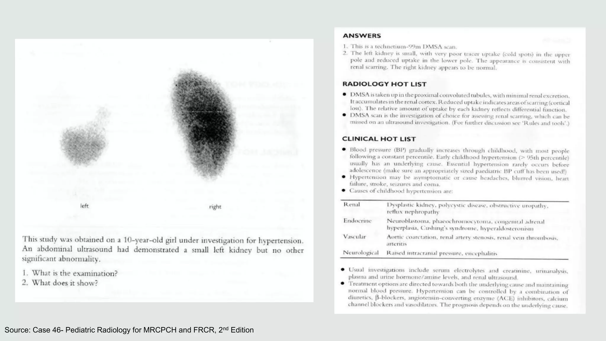 Pediatric Nephrology Radiology Review | PPT