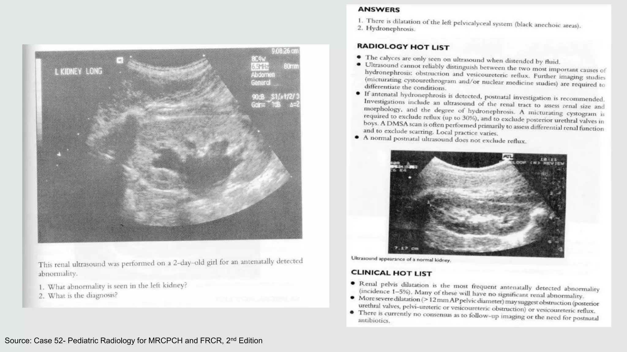 Pediatric Nephrology Radiology Review | PPT