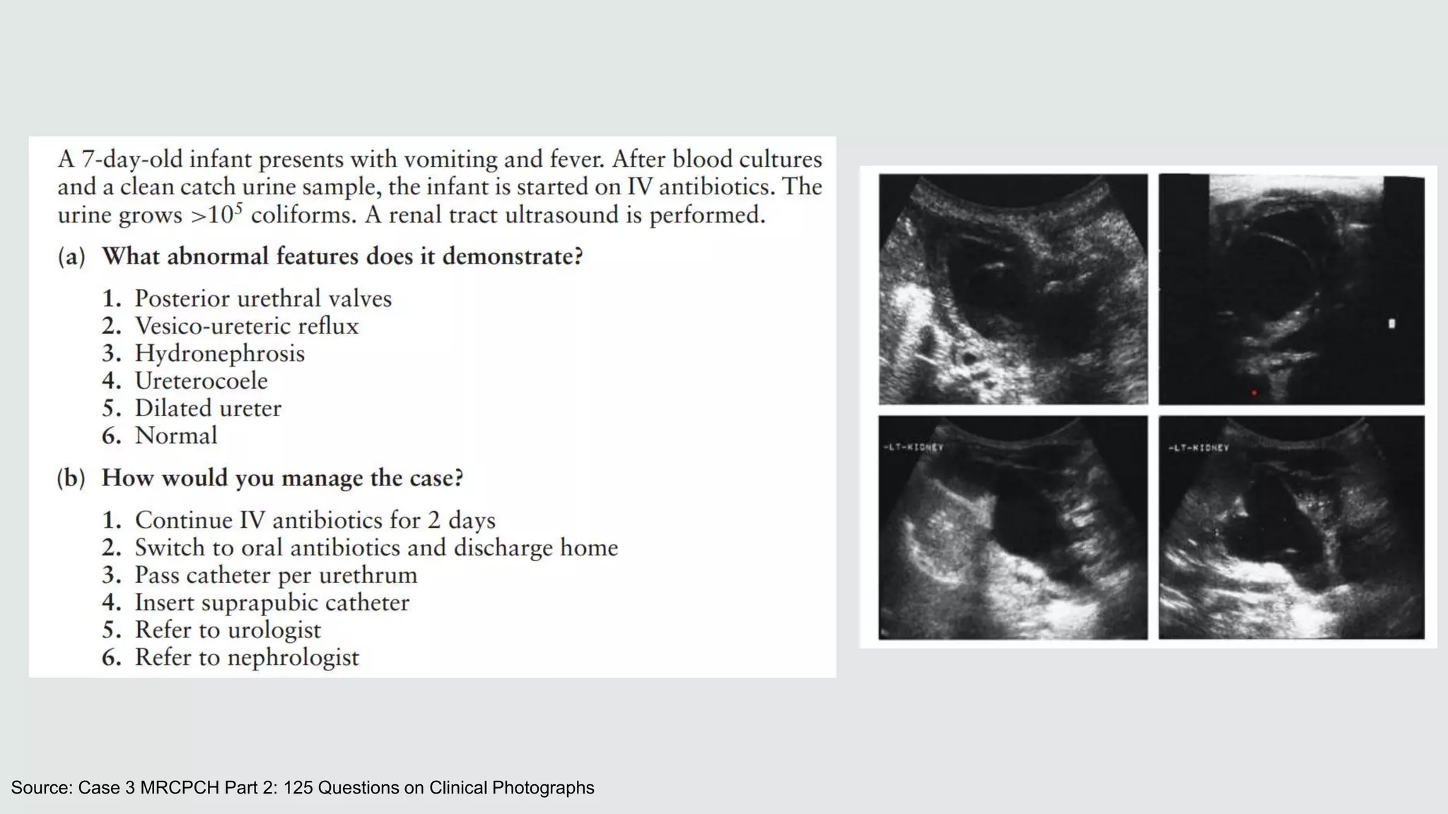 Pediatric Nephrology Radiology Review | PPT