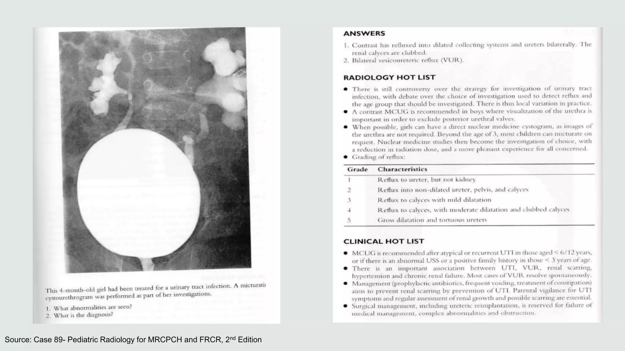 Pediatric Nephrology Radiology Review | PPT