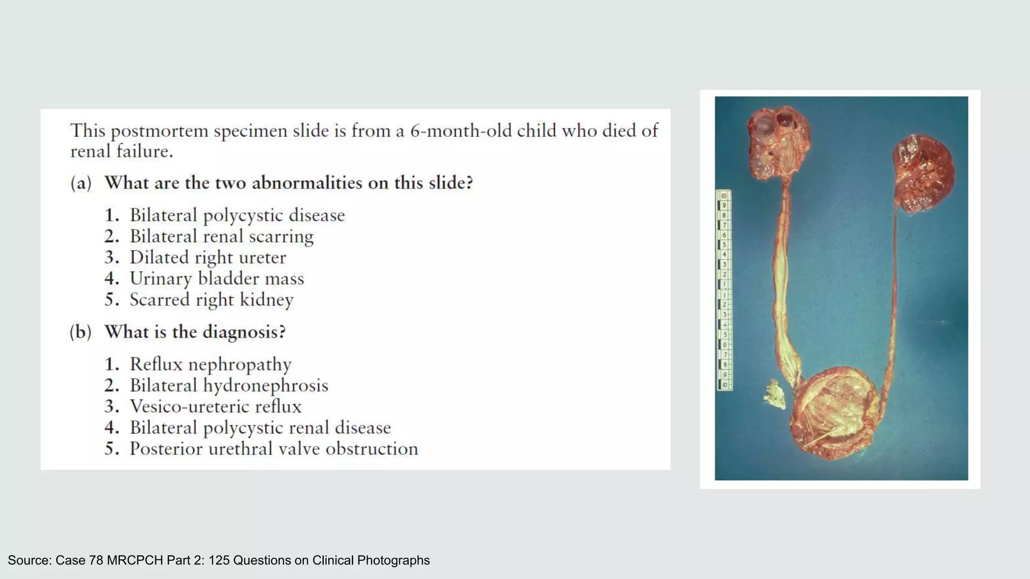 Pediatric Nephrology Radiology Review | PPT