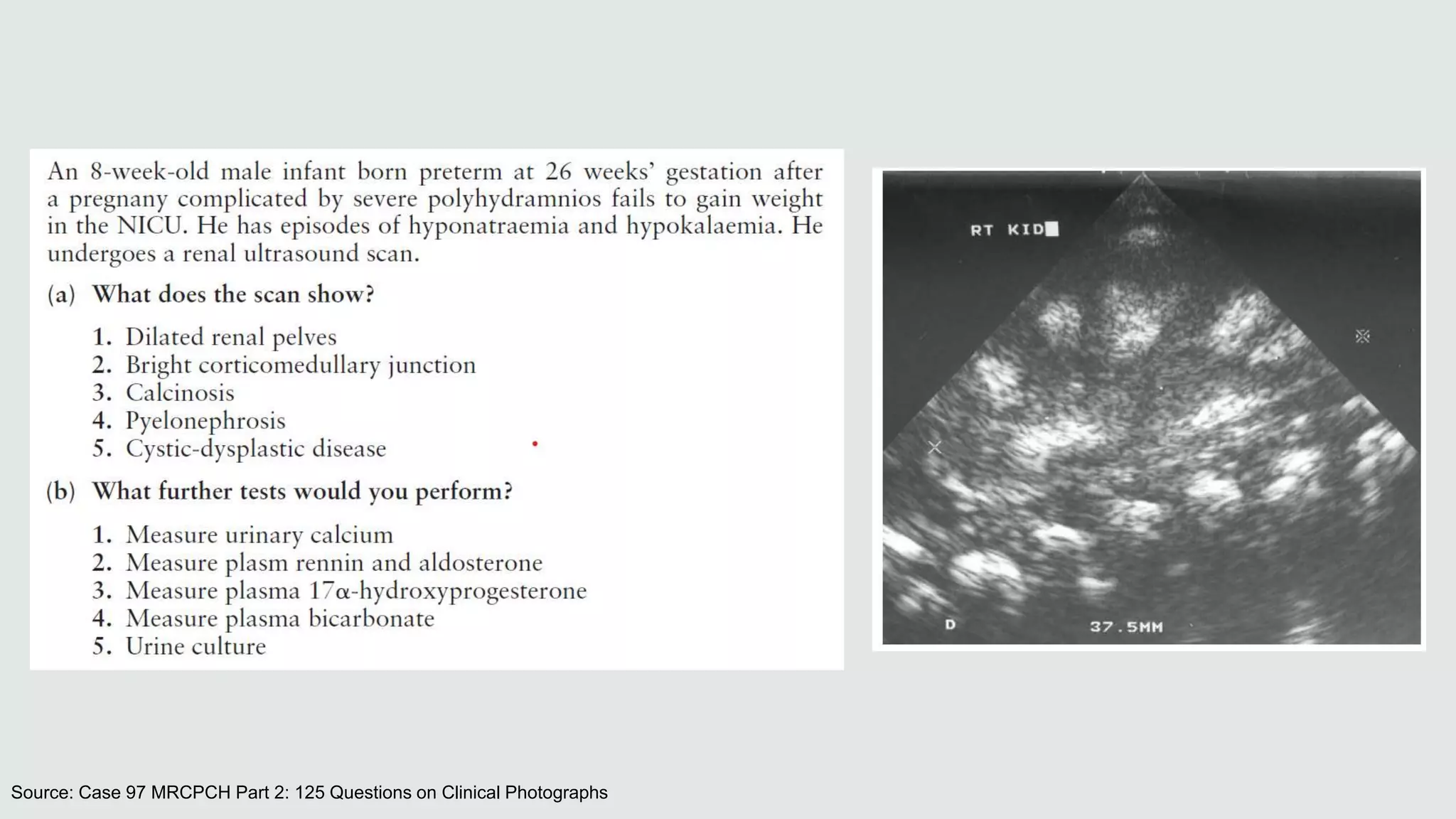 Pediatric Nephrology Radiology Review | PPT