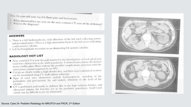 Pediatric Nephrology Radiology Review | PPT