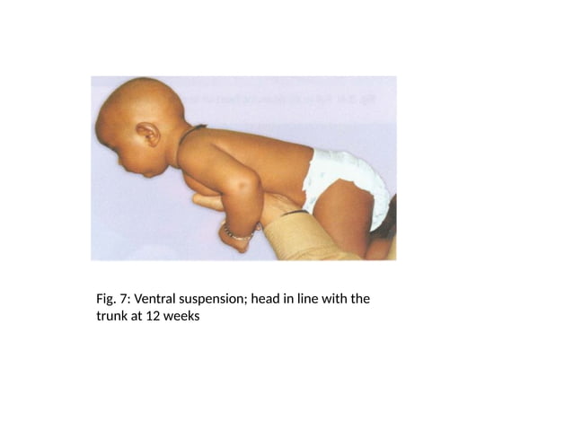 pediatric neuro assessmentvudthuvhjj.pptx