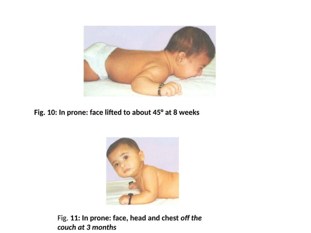 pediatric neuro assessmentvudthuvhjj.pptx