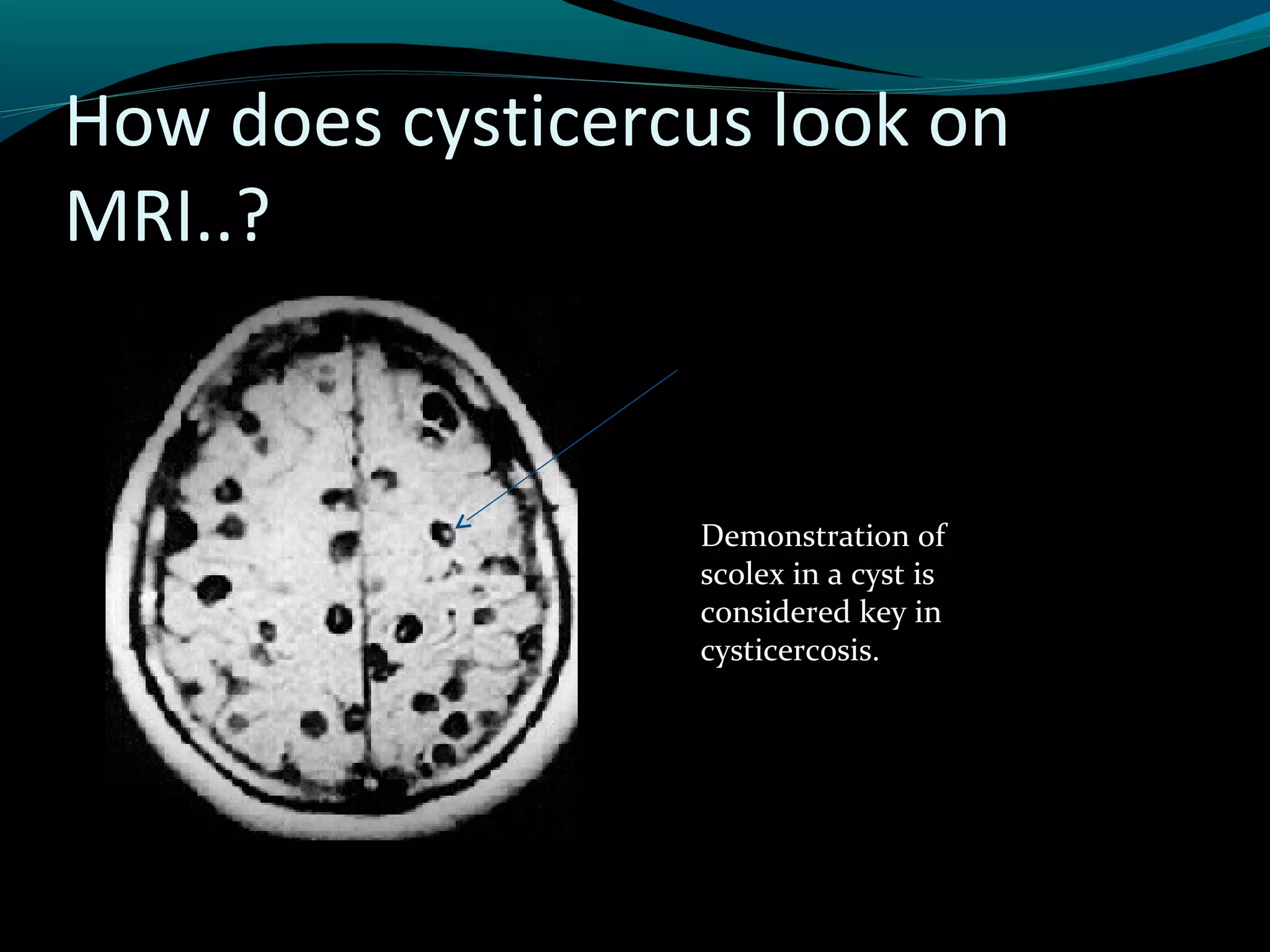 Pediatric neuroimaging | PPT