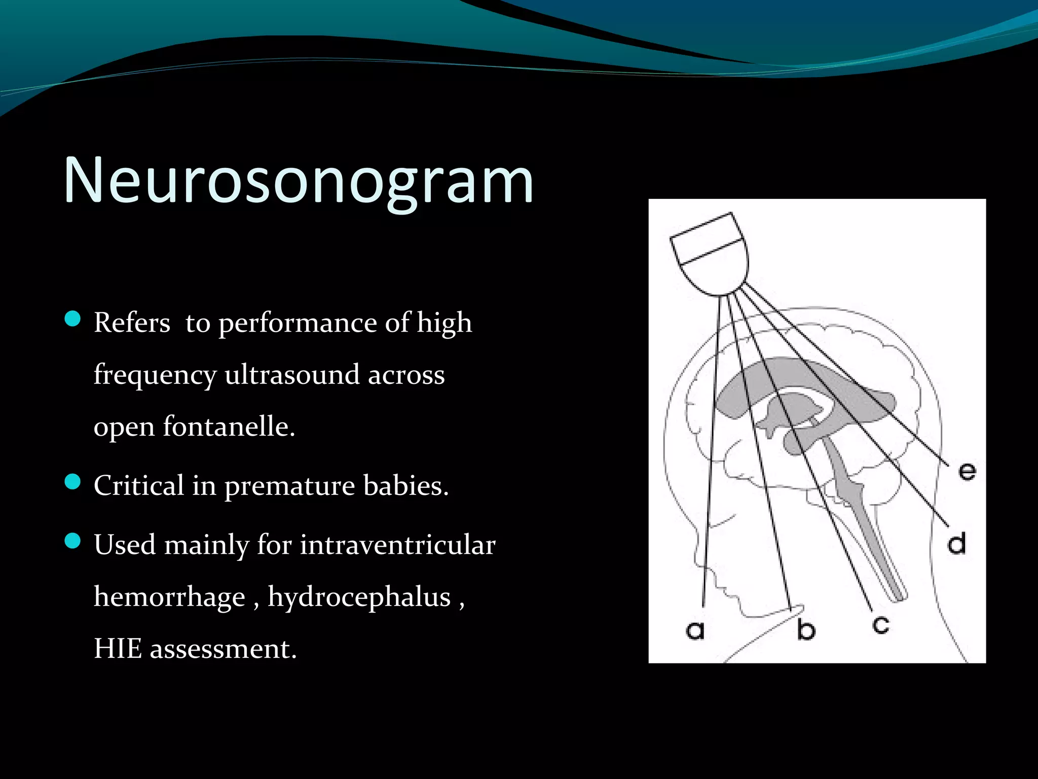 Pediatric neuroimaging | PPT