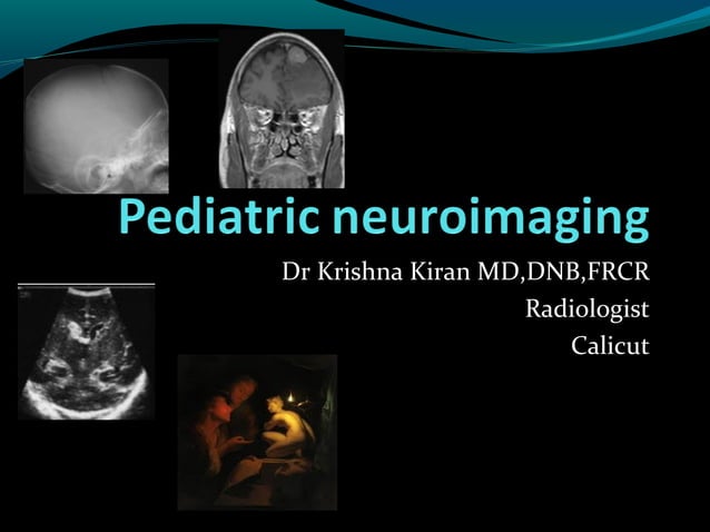 Pediatric neuroimaging | PPT | Brain and Nervous System Disorders ...