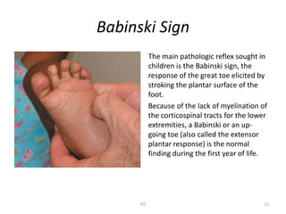 Pediatric neurological examination vit | PDF | Foot Health | Diseases ...