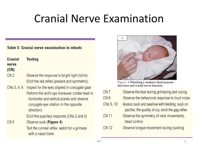 Pediatric neurological examination vit | PPT