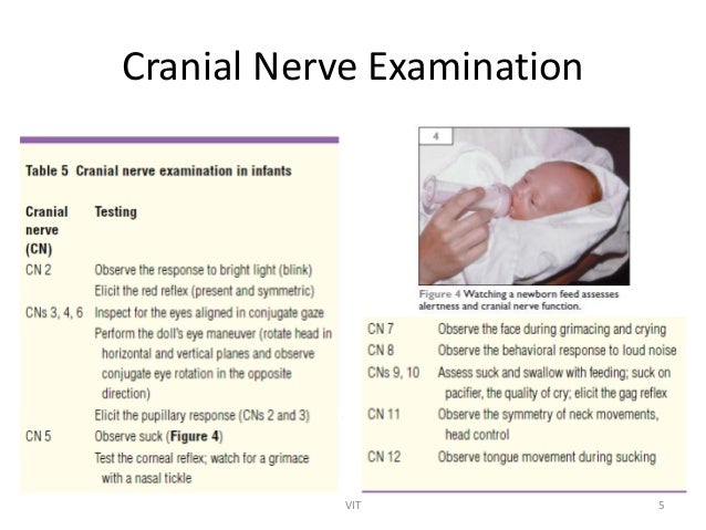 Pediatric neurological examination vit