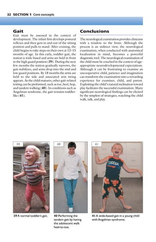 Pediatric neurology, a color handbook bale jr., james f. [srg] | PDF