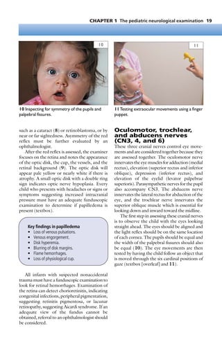 Pediatric neurology, a color handbook bale jr., james f. [srg] | PDF