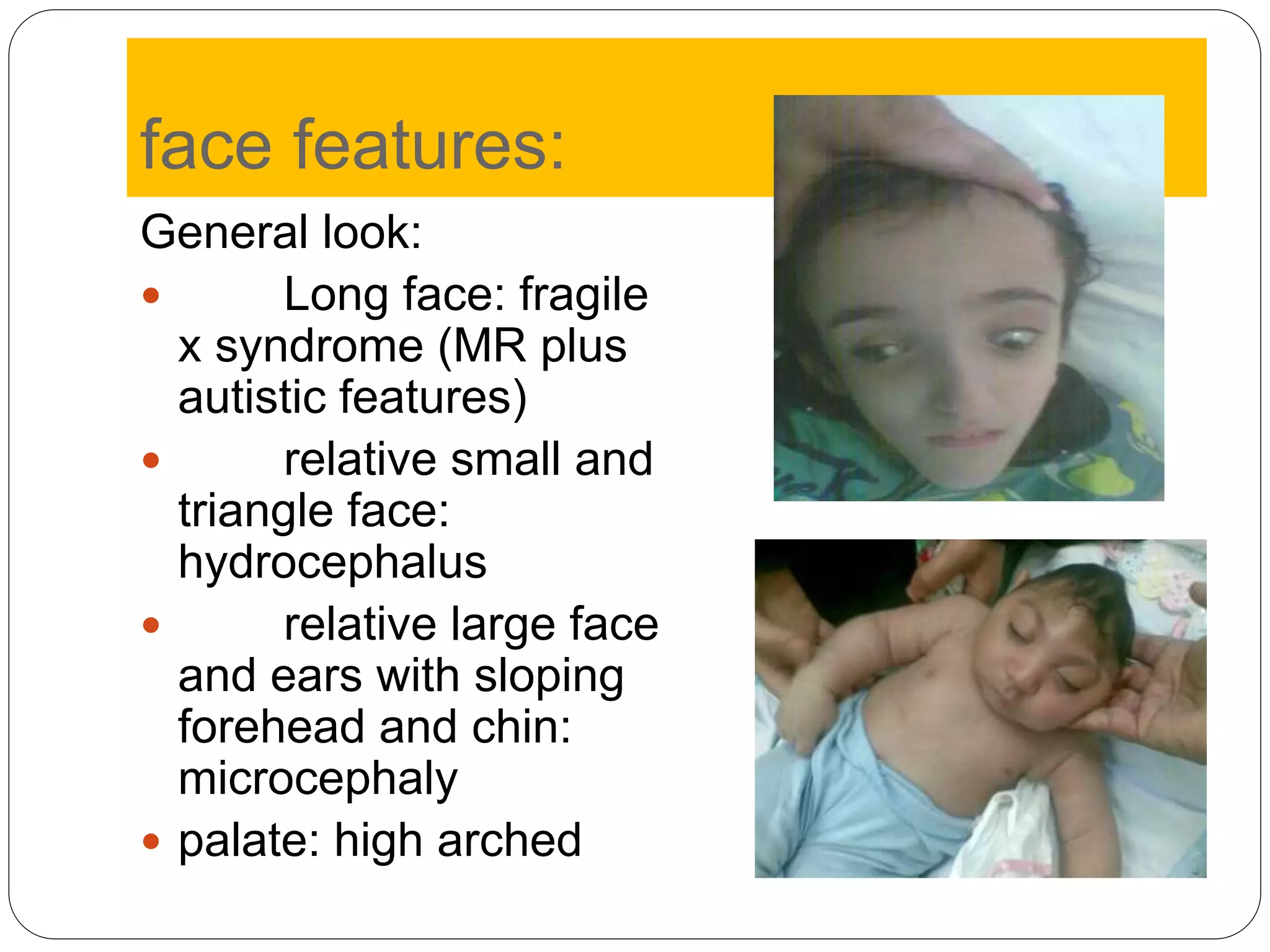 Pediatric neurology examination make it easy | PPTX