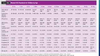 Pediatric normal ecg | PPTX