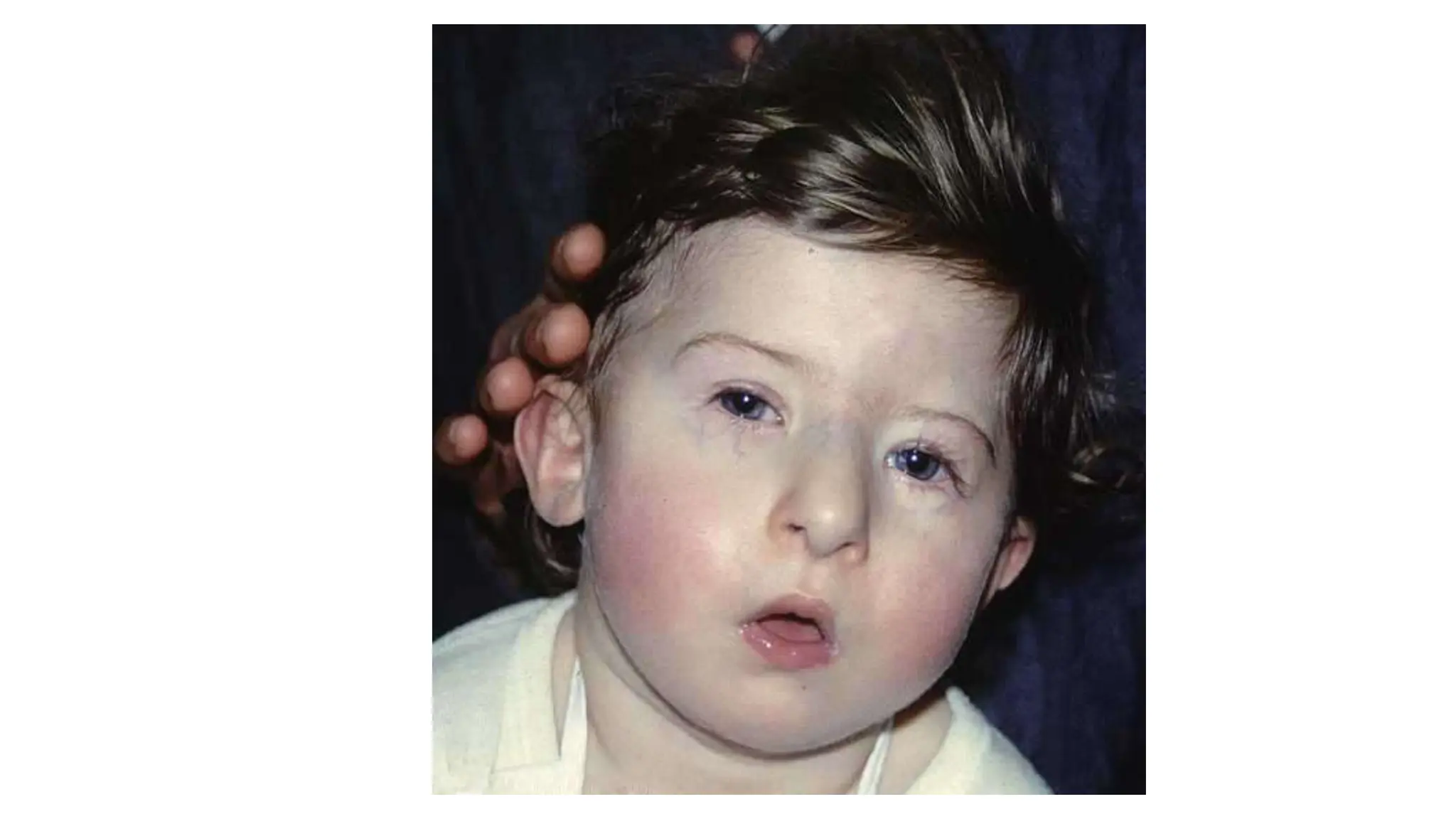 Pediatric obesity and its related complications.pptx