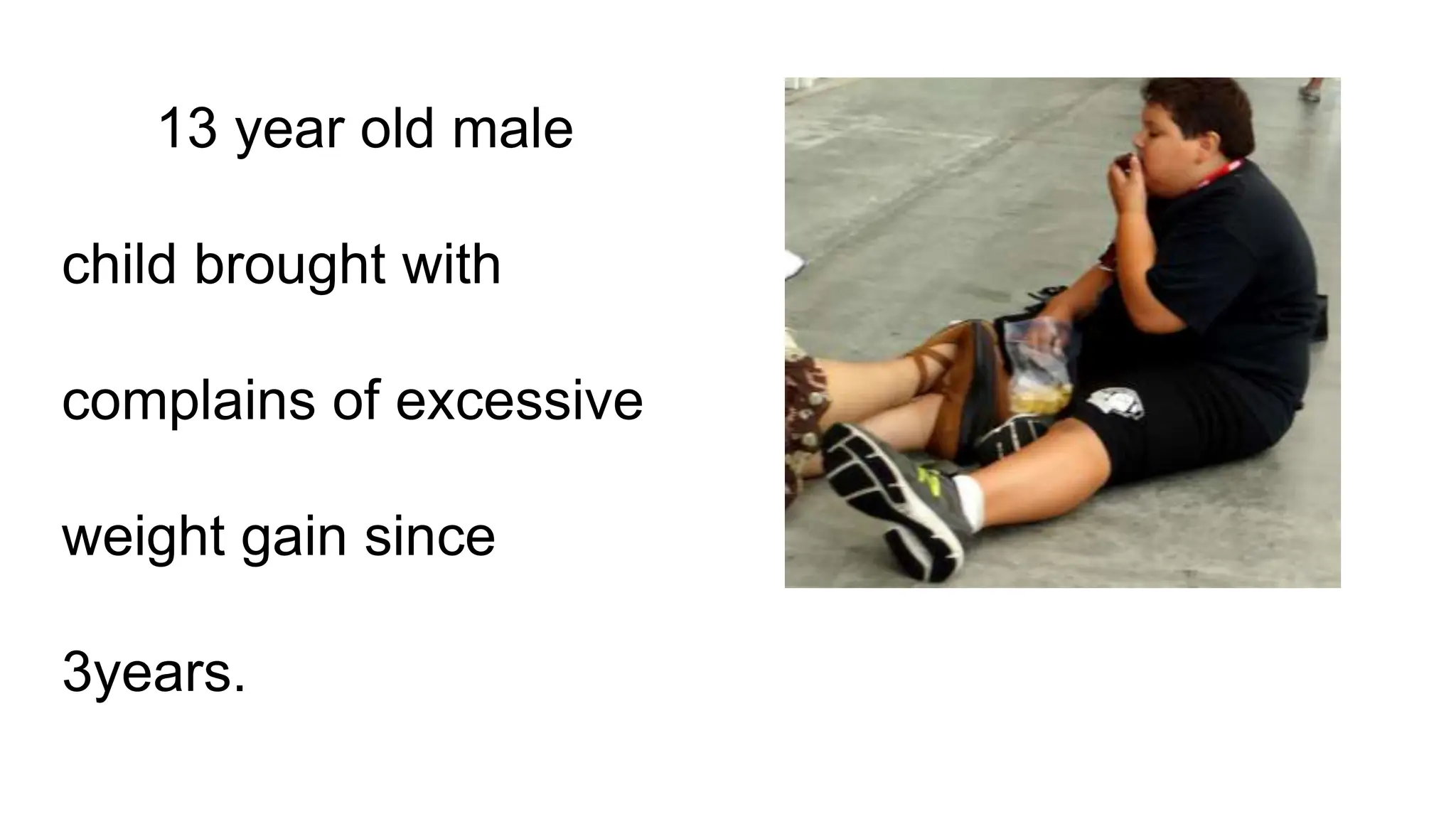 Pediatric obesity and its related complications.pptx