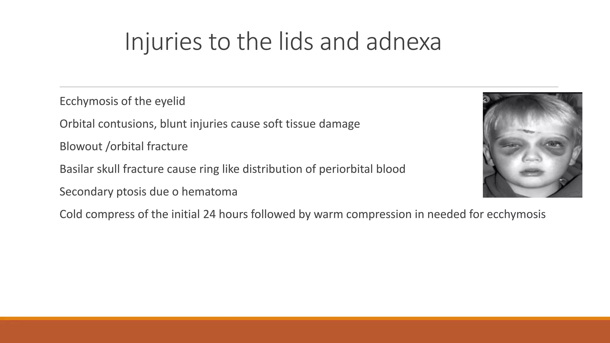 Pediatric Ocular Trauma.pptx