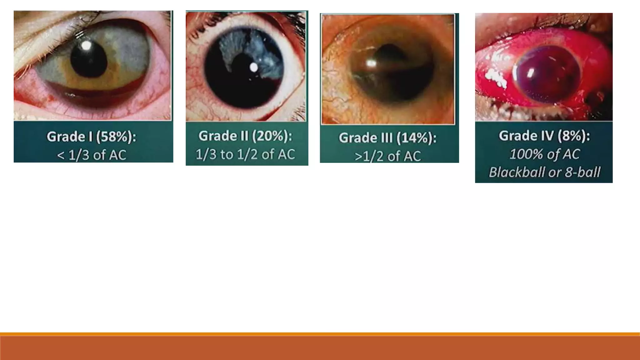 Pediatric Ocular Trauma.pptx