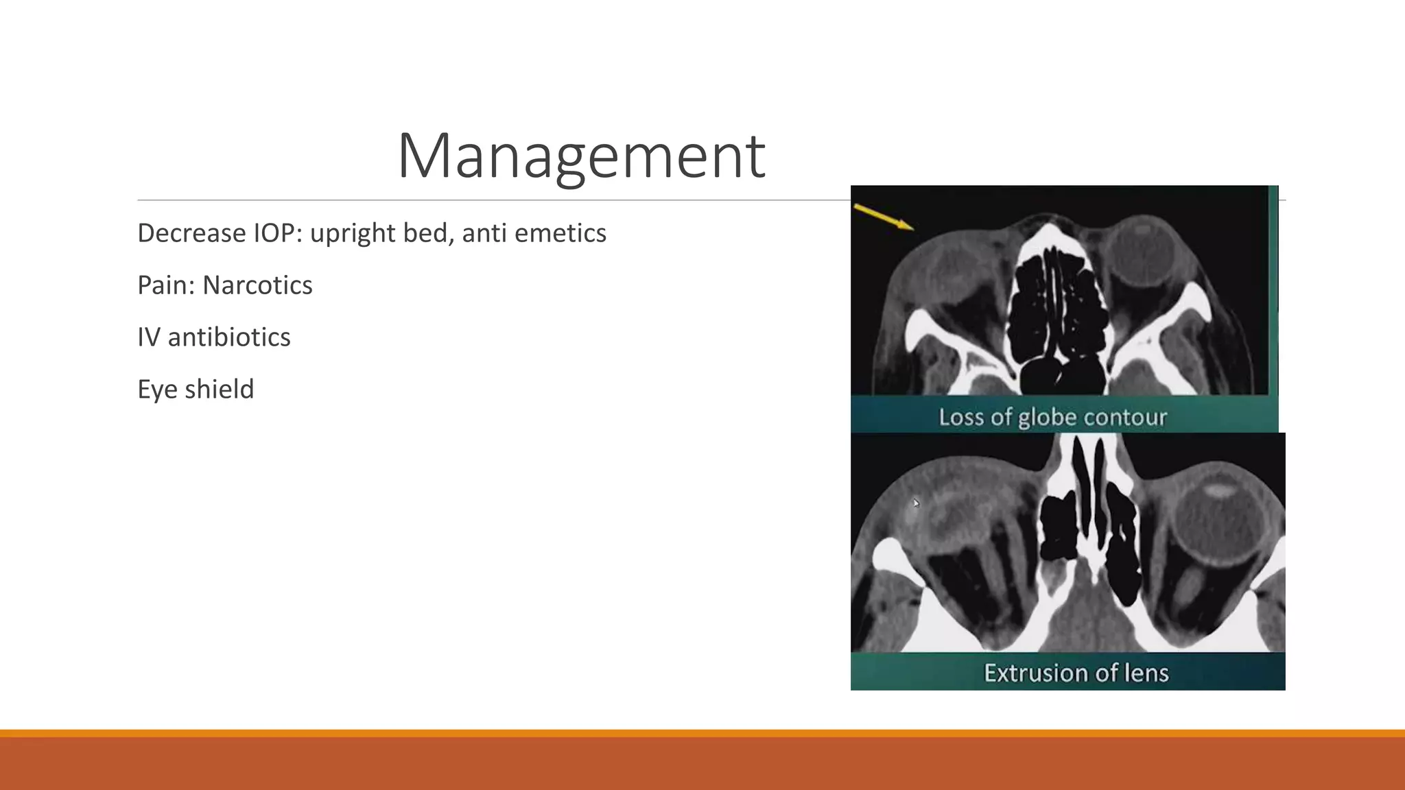 Pediatric Ocular Trauma.pptx