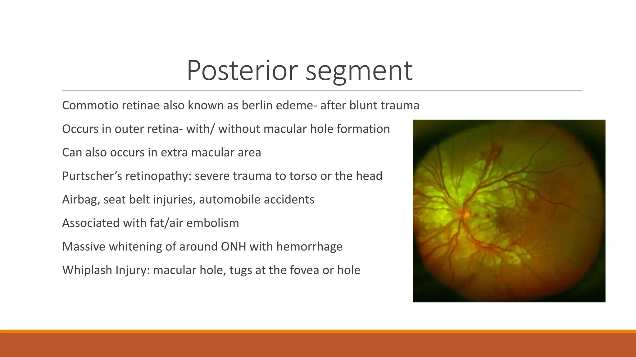 Pediatric Ocular Trauma.pptx