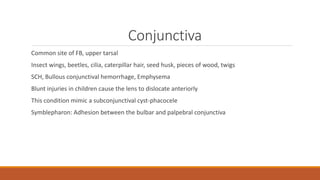 Pediatric Ocular Trauma.pptx