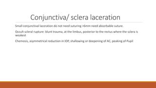 Pediatric Ocular Trauma.pptx