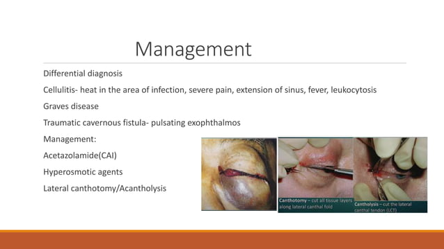 Pediatric Ocular Trauma.pptx