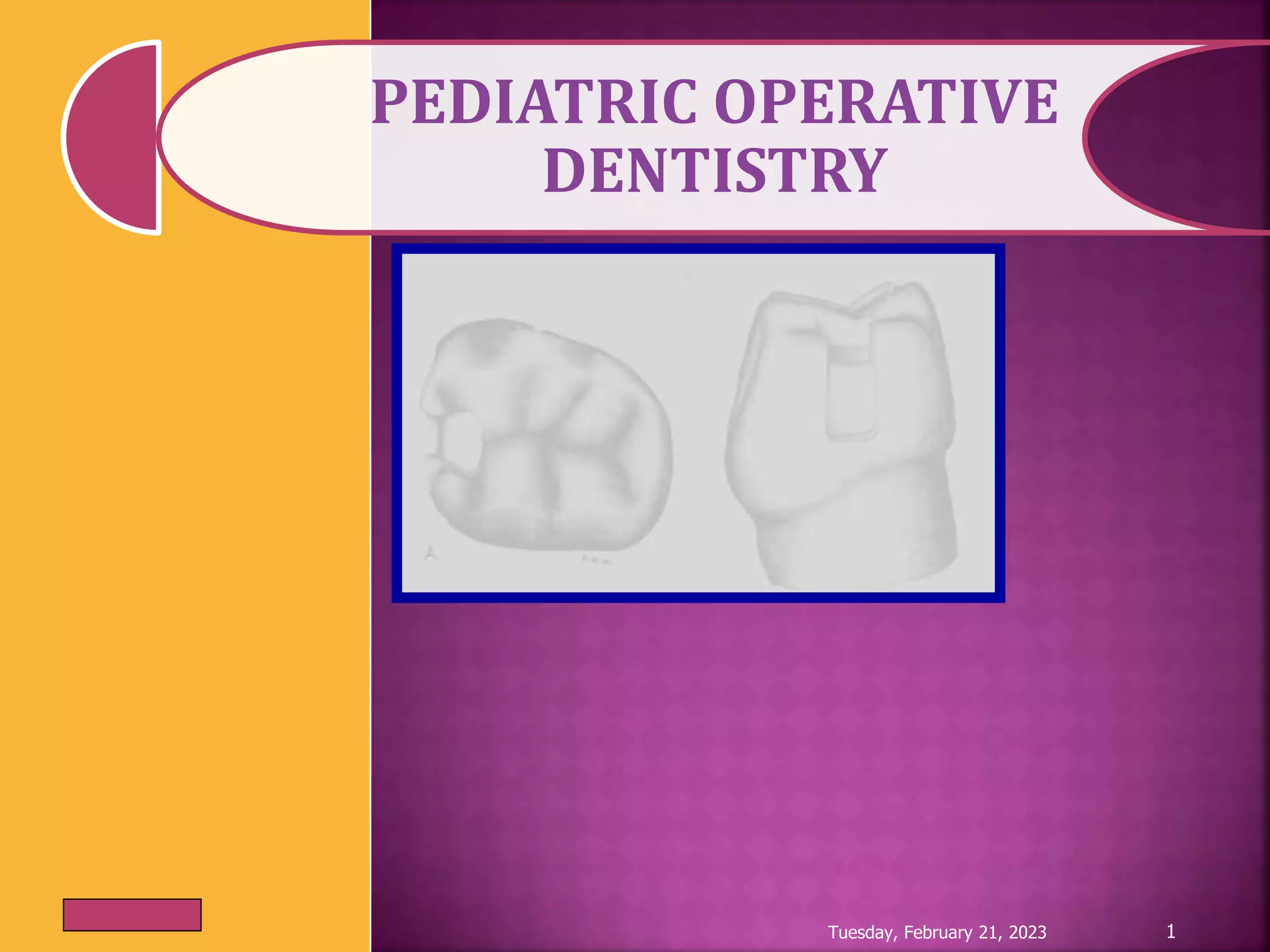 Pediatric Operative Dentistry.ppt