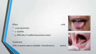 Pediatric oral abnormalities | PPTX