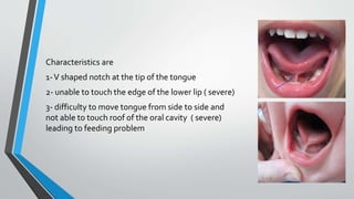 Pediatric oral abnormalities | PPTX