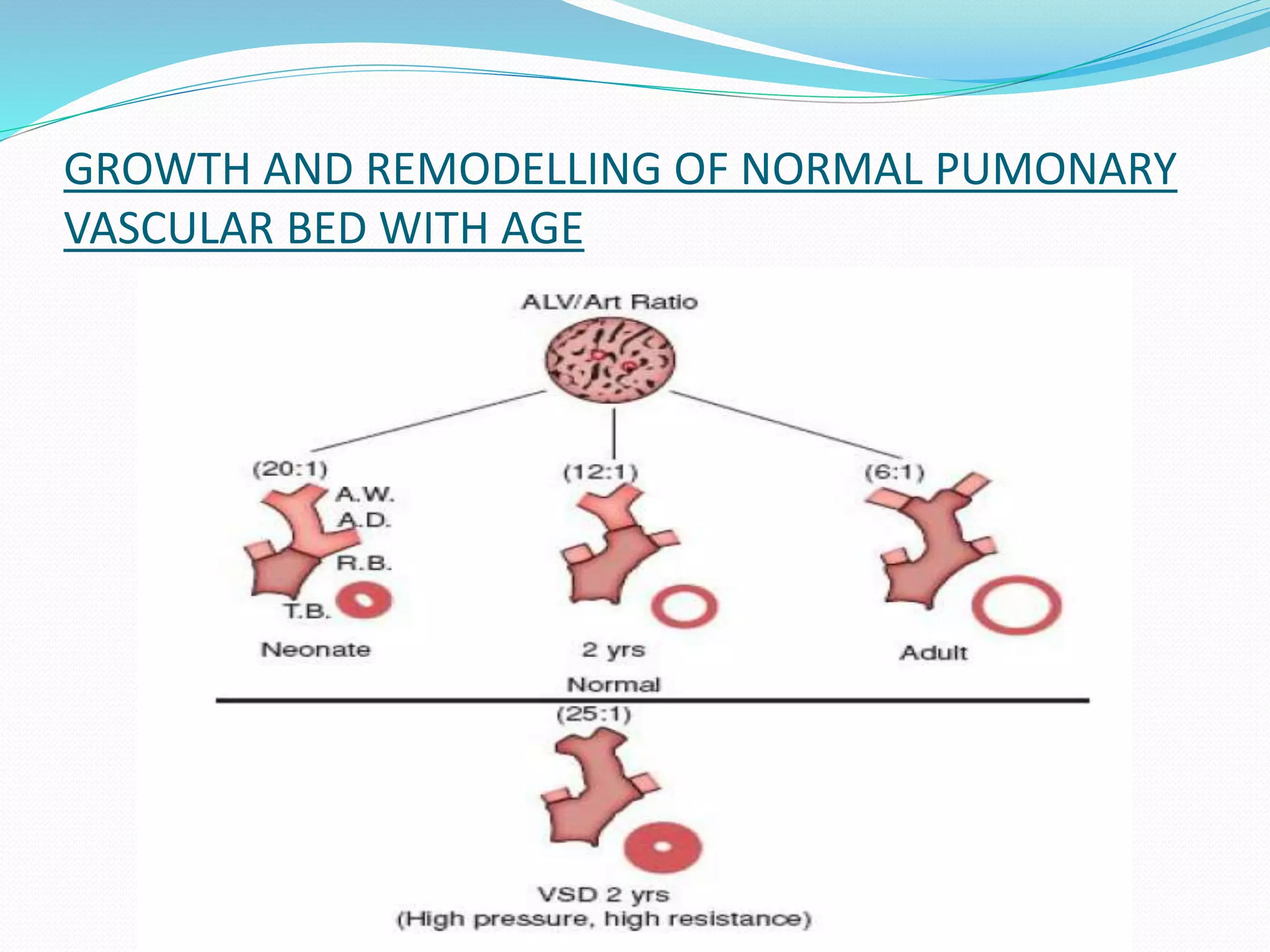Pediatric pulmonary hypertension | PPTX