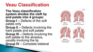 pediatric plastic anethesia cleft lip and palate.pptx