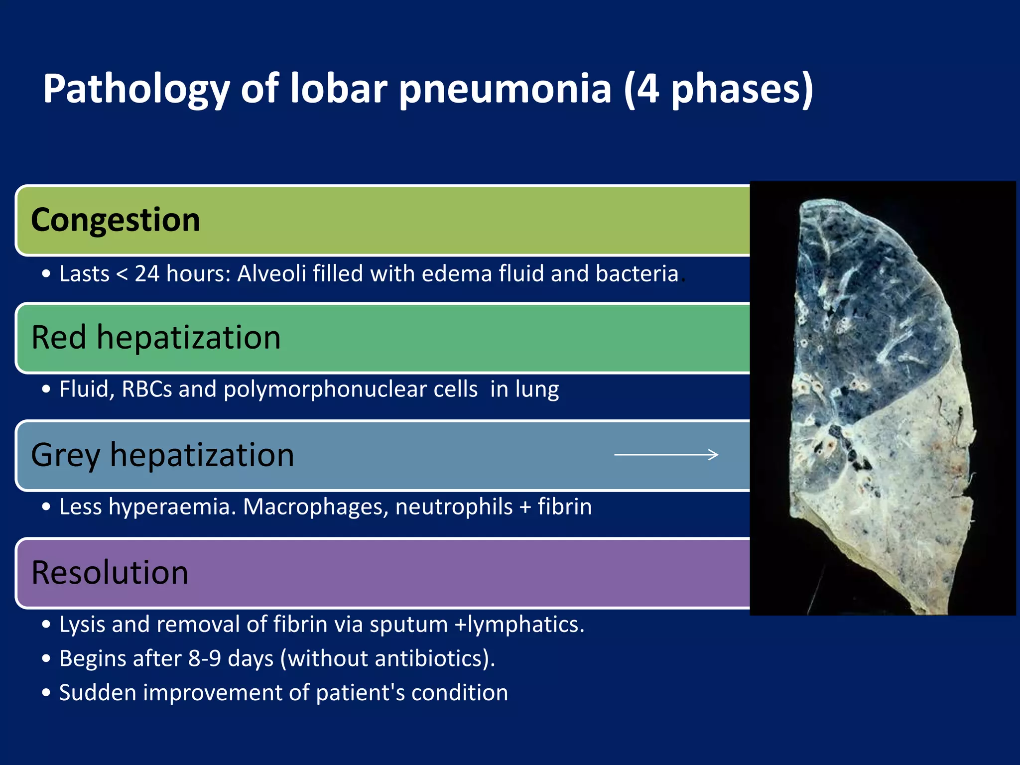 pediatric Pneumonia.pptx