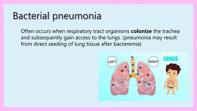 Pediatric pneumonia sadeghpour | PPTX | Infectious Diseases | Diseases ...